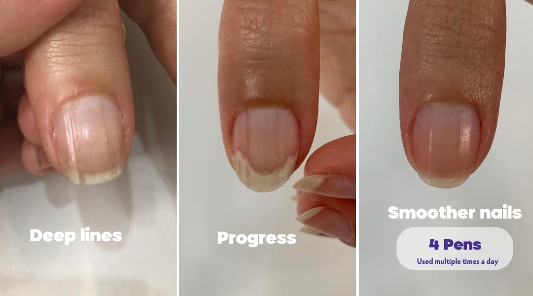 What happened to my nails? I got ridges! – Daline Nails