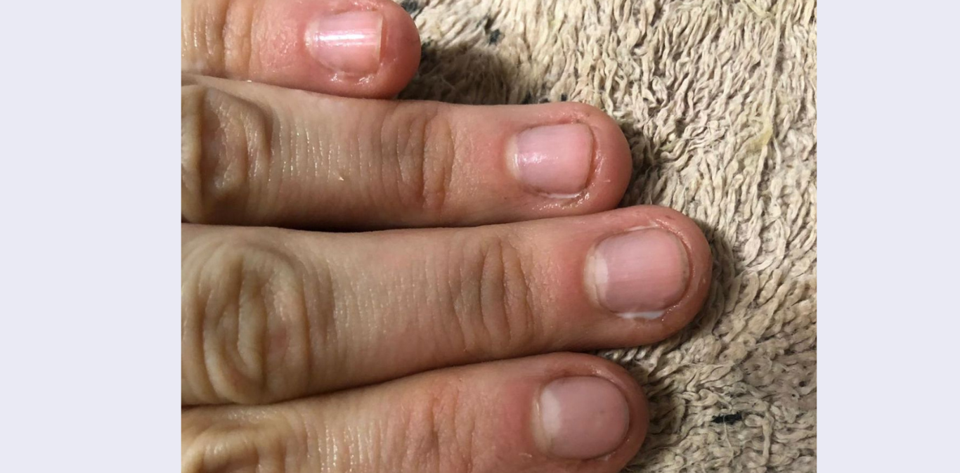 Magic Pen Daily Nail Creme: Repairs & Grow Nails, moisturise cuticles ...